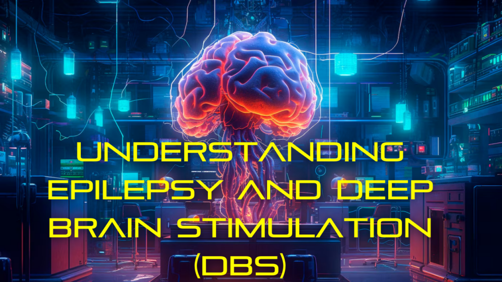 Understanding Epilepsy And Deep Brain Stimulation (DBS) - The Study IAS