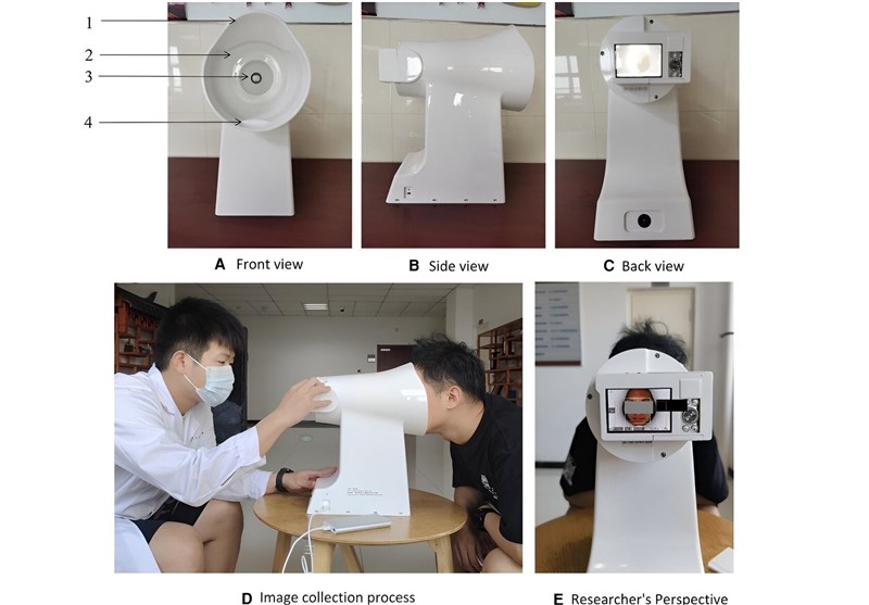 AI-Based Tongue Imaging - The Study IAS
