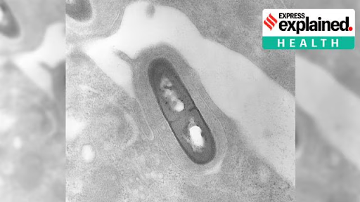 Listeria Outbreak In United States & Canada - The Study IAS